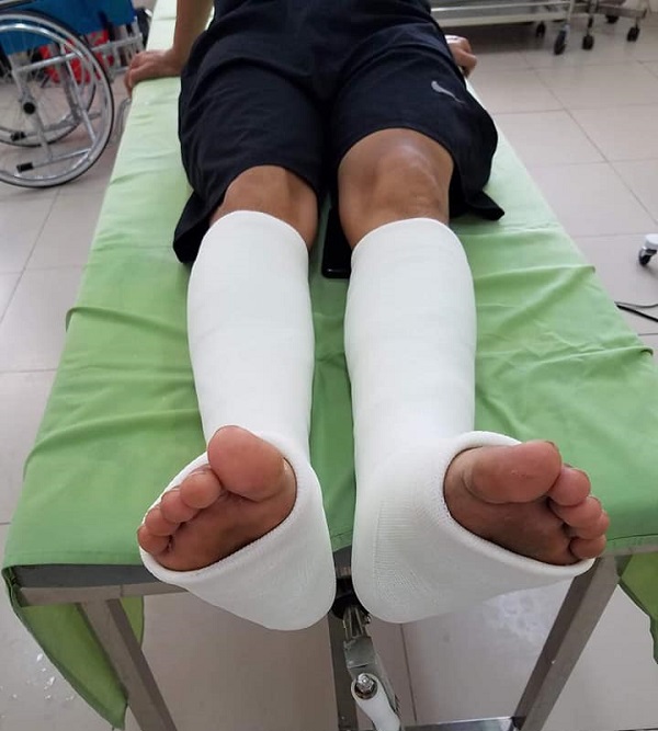 Ứng dụng và ưu điểm của bột bó thủy tinh (bột bó nhựa, bột bó sợi thủy ...